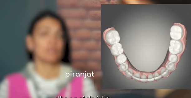 Vjen në Shqiperi per te rregulluar dhembet shikoni pasojat qe i len me ...